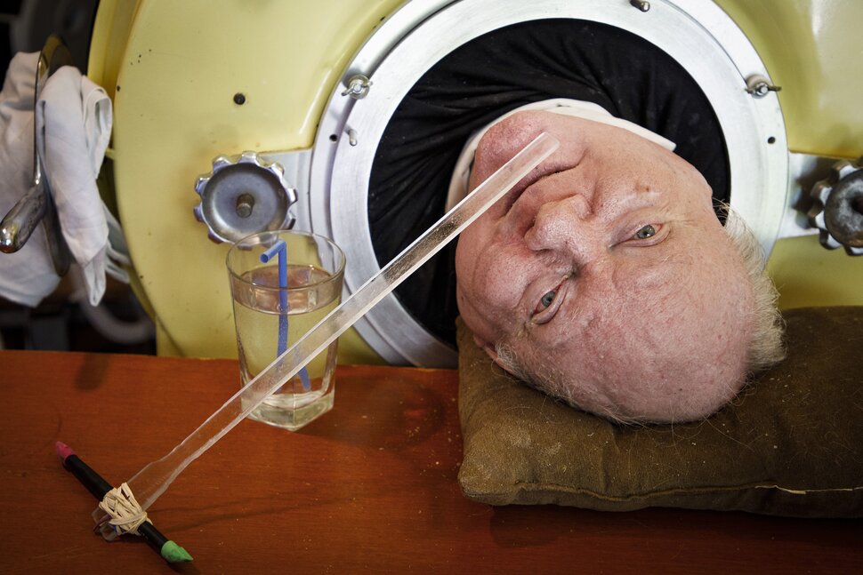 Polio Paul’s Remarkable 70-Year Survival Inside An Iron Lung - The ...