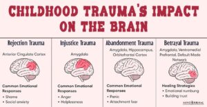 How Does Childhood Trauma Affect The Brain?4 Emotional Scars